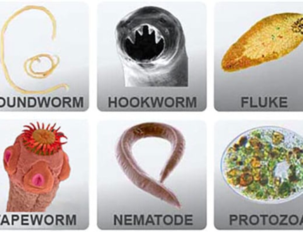 Worms in your body are a leading cause of hyper-infection of bacteria ...