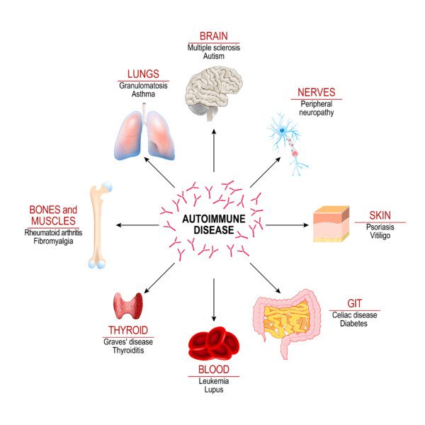 Autoimmune Disease Treatment - Biologix Center for Optimum Health